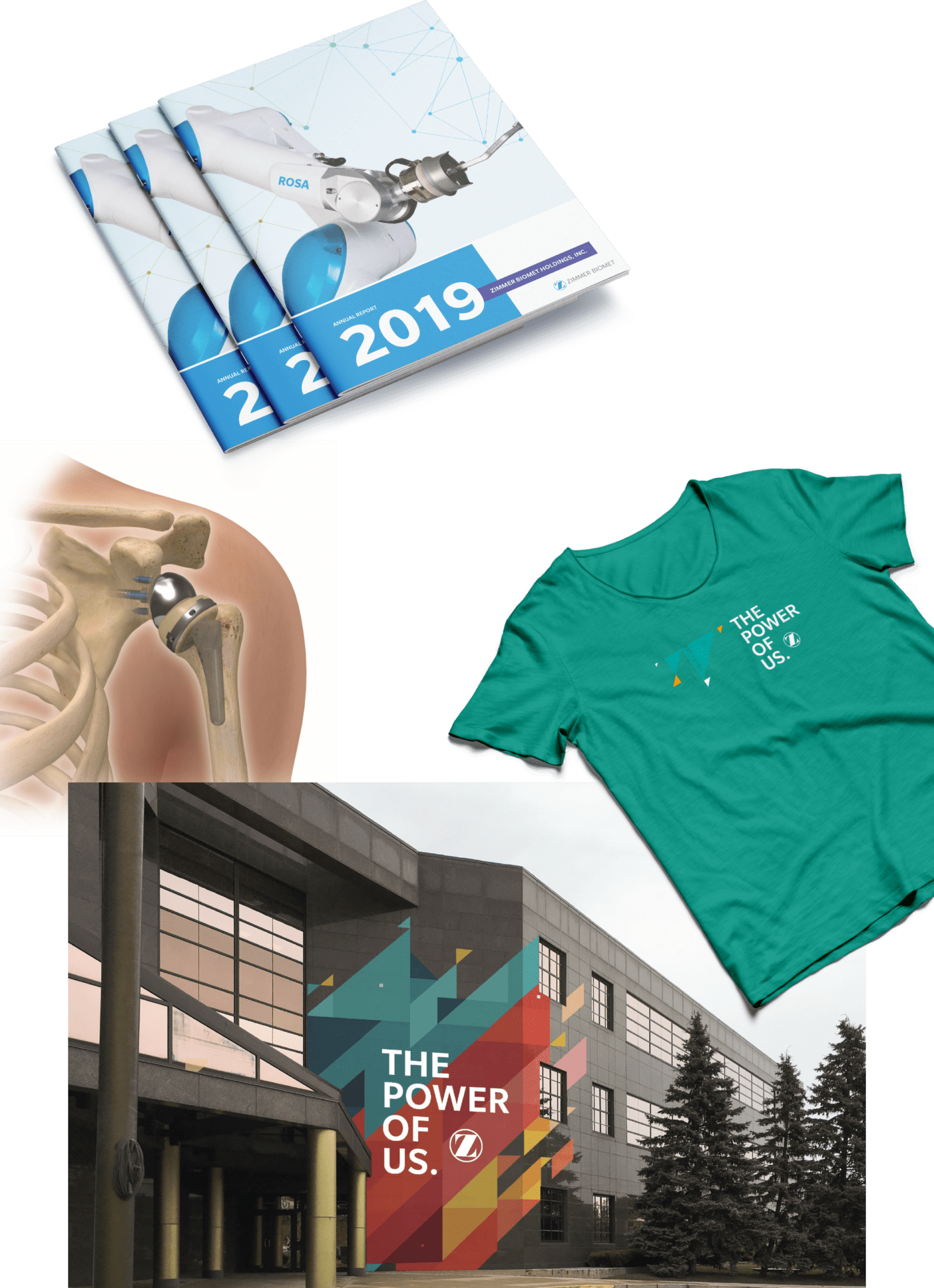 Zimmer Biomet | Case Study | Ferguson
